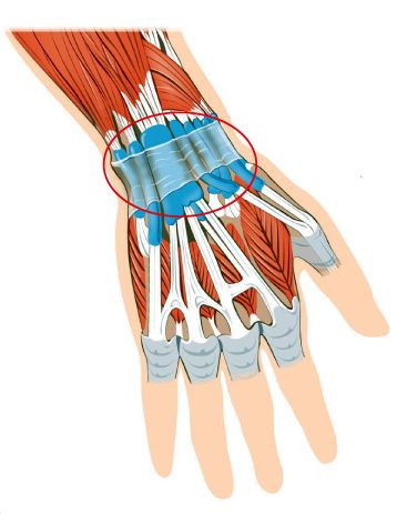 Leziuni, afectiuni la mana